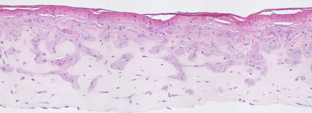 In vitro Skin Absorption Tests, Dermal Penetration - Xenometrix