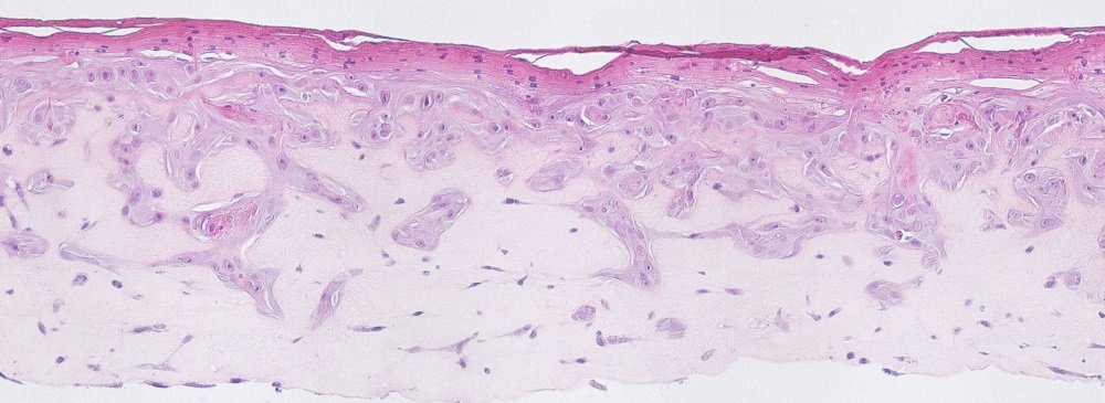 Franz Diffusion Cells